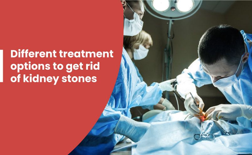 Different Treatment Options to Get Rid of Kidney Stones ...