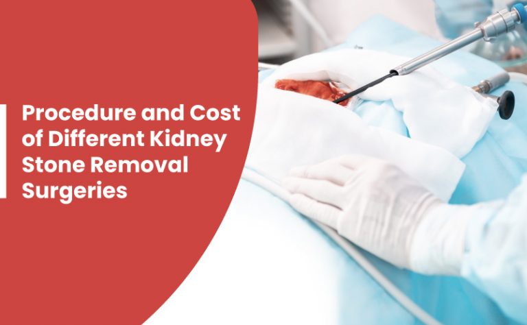 Procedure & Cost of Different Kidney Stone Removal Surgeries